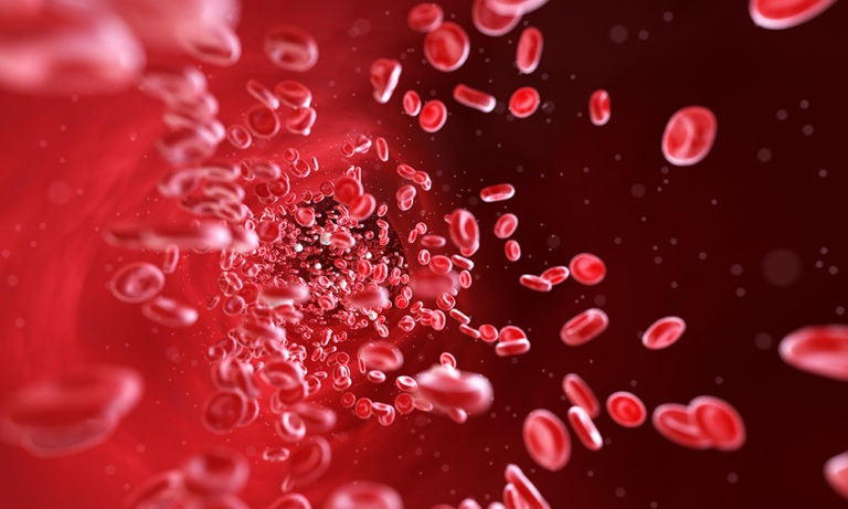 採血なしでヘモグロビン量を測定「astrim-fit」